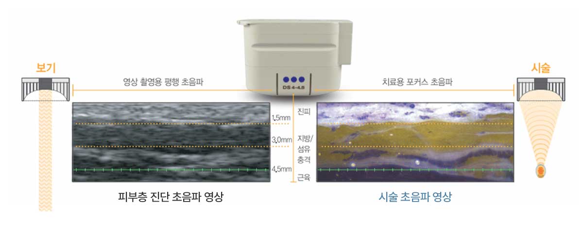 뷰커스의원 - 강서 피부과 | 가양역 피부과